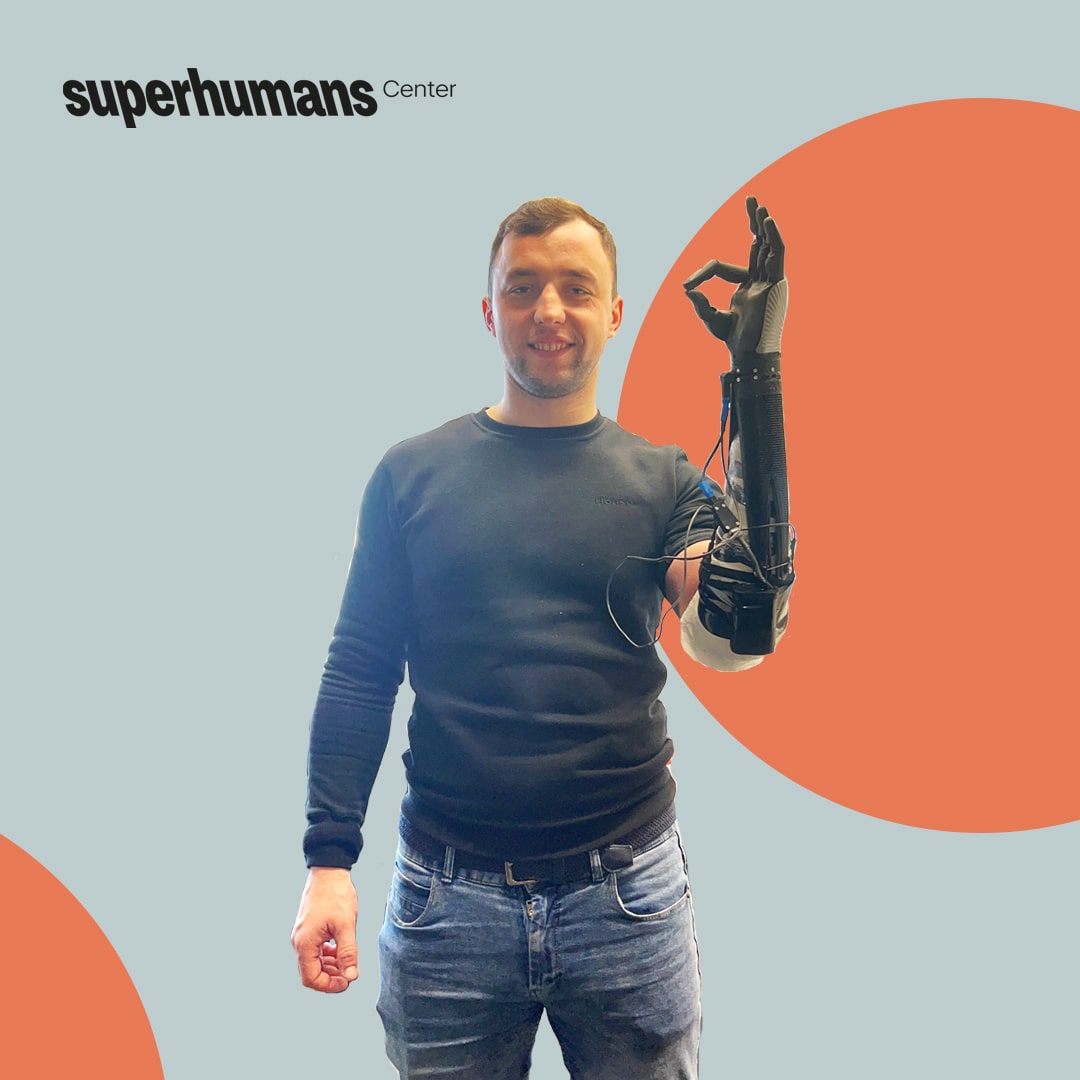 Superhumans встановить двом українським захисникам сучасні біонічні ...